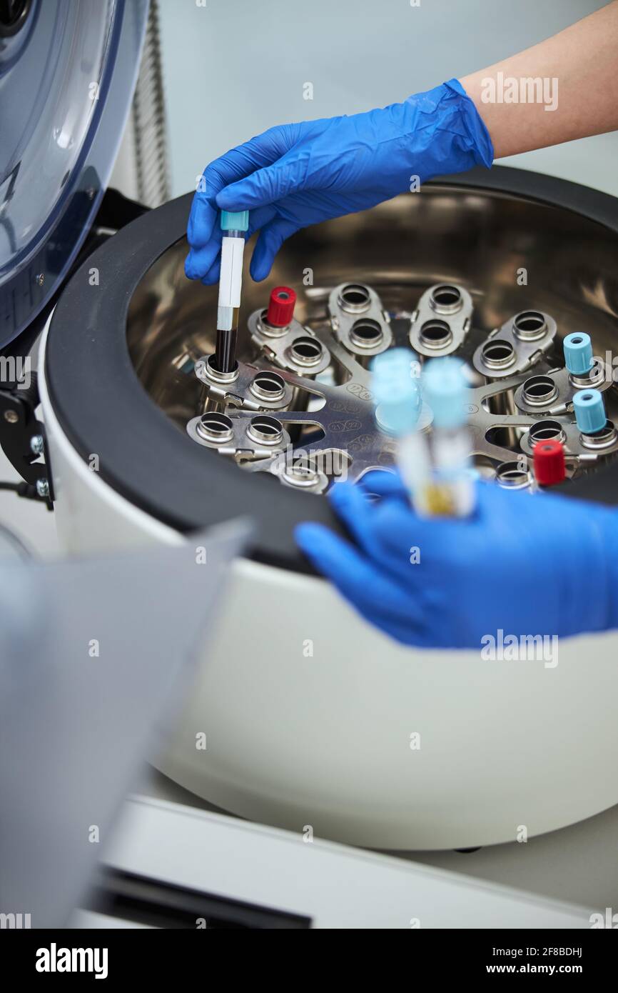 Vacutainer High Resolution Stock Photography and Images - Alamy