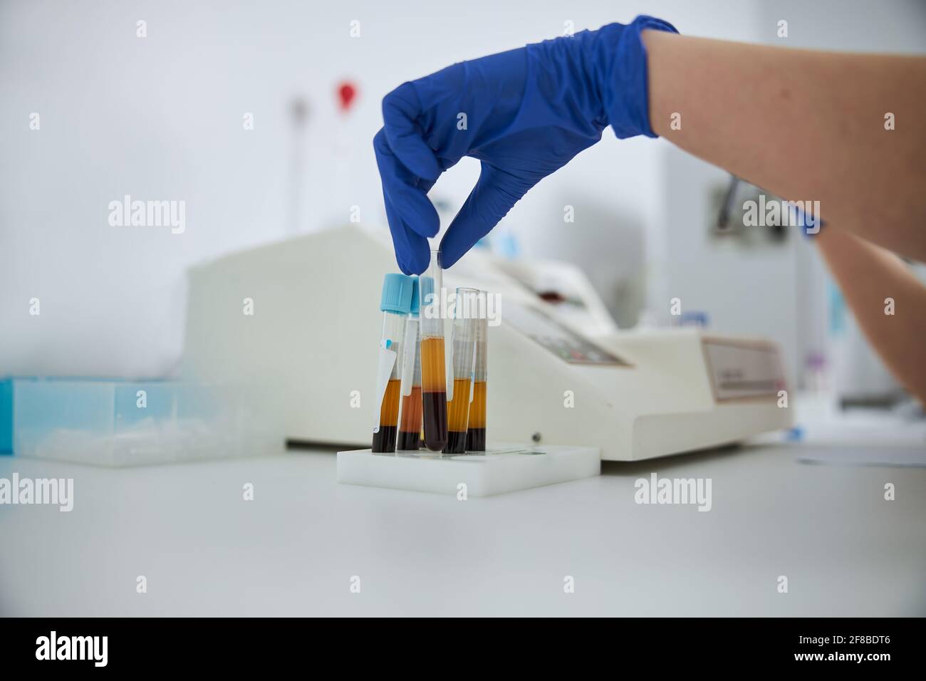 Laboratory worker choosing a sample for a coagulation test Stock Photo ...