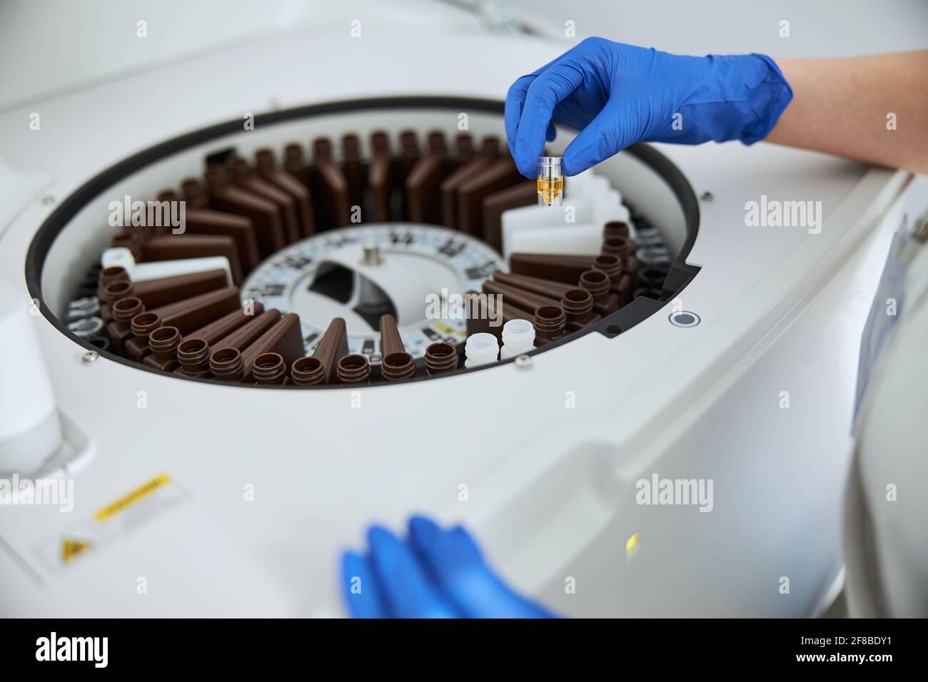 Biochemical test hi-res stock photography and images - Alamy