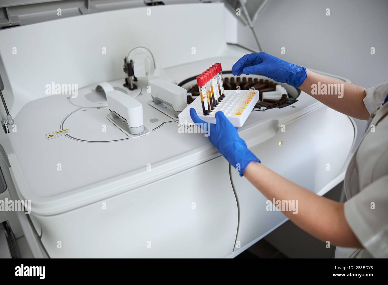 Blood chemistry analyzer hi-res stock photography and images - Alamy