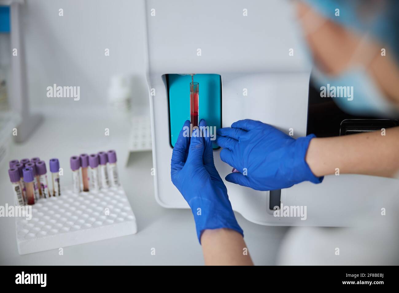 Biochemical analyzer hi-res stock photography and images - Alamy