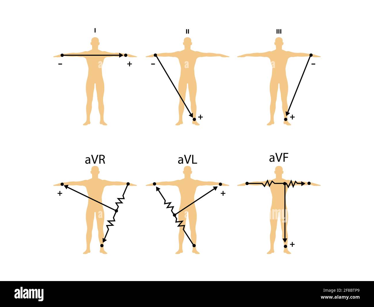 Einthoven ECG triangle, including augmented unipolar limb lead ...