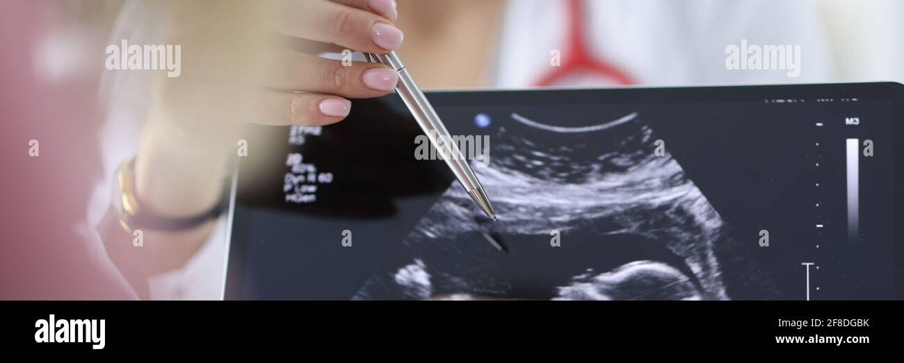 Doctor shows pregnant woman an ultrasound scan of fetus Stock Photo - Alamy