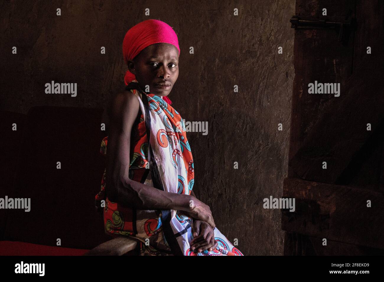 Hunchback woman hi-res stock photography and images - Alamy