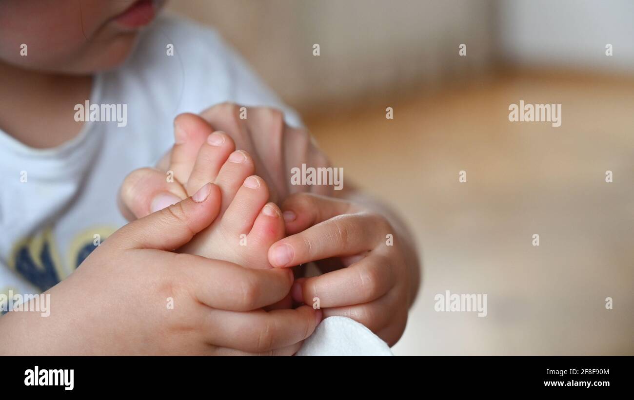 Injured leg of the child, abrasions in the child. Callus on the toe ...