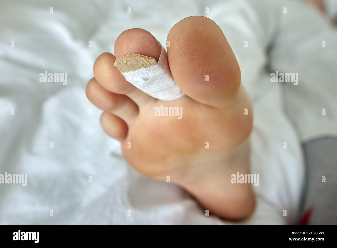 Finger fracture first aid hi-res stock photography and images - Alamy