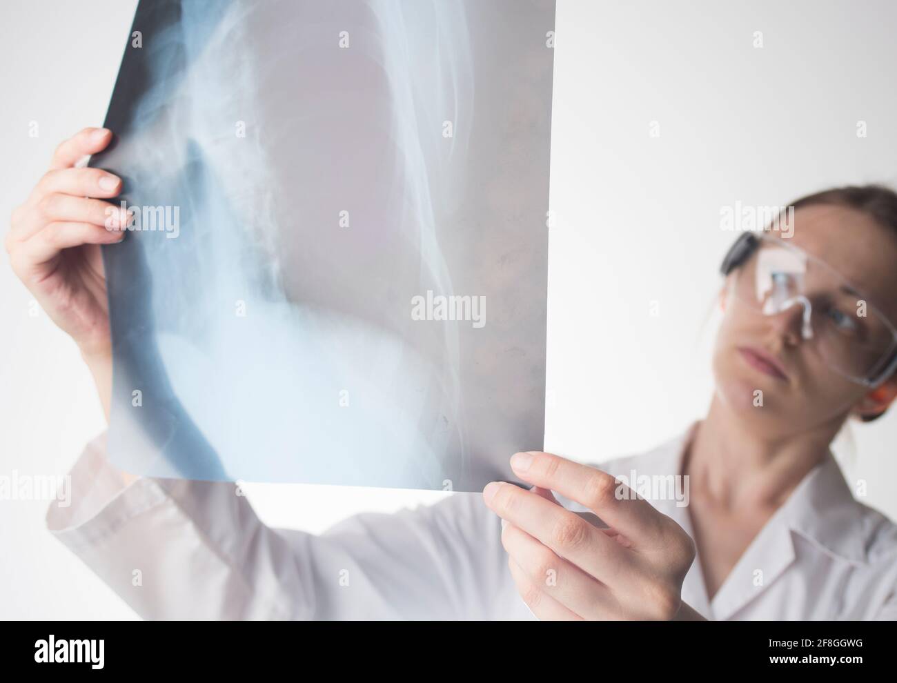 Doctor looking chest x-ray Stock Photo - Alamy