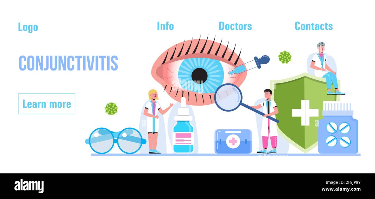 Conjunctivitis concept vector.Eye doctor concept for health care banner ...