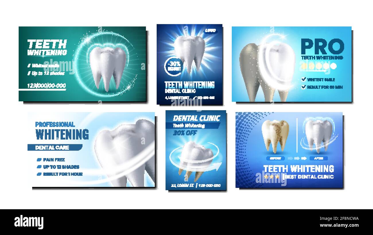 Teeth Whitening Promotional Posters Set Vector Stock Vector Image & Art ...