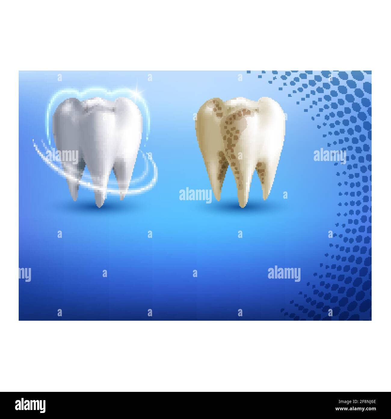 Teeth Whitening Creative Promotional Poster Vector Stock Vector Image ...