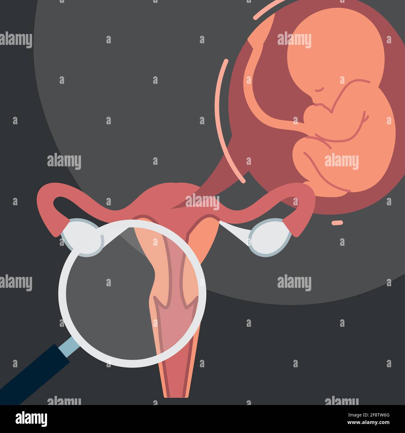 Cervix check Stock Vector Images - Alamy