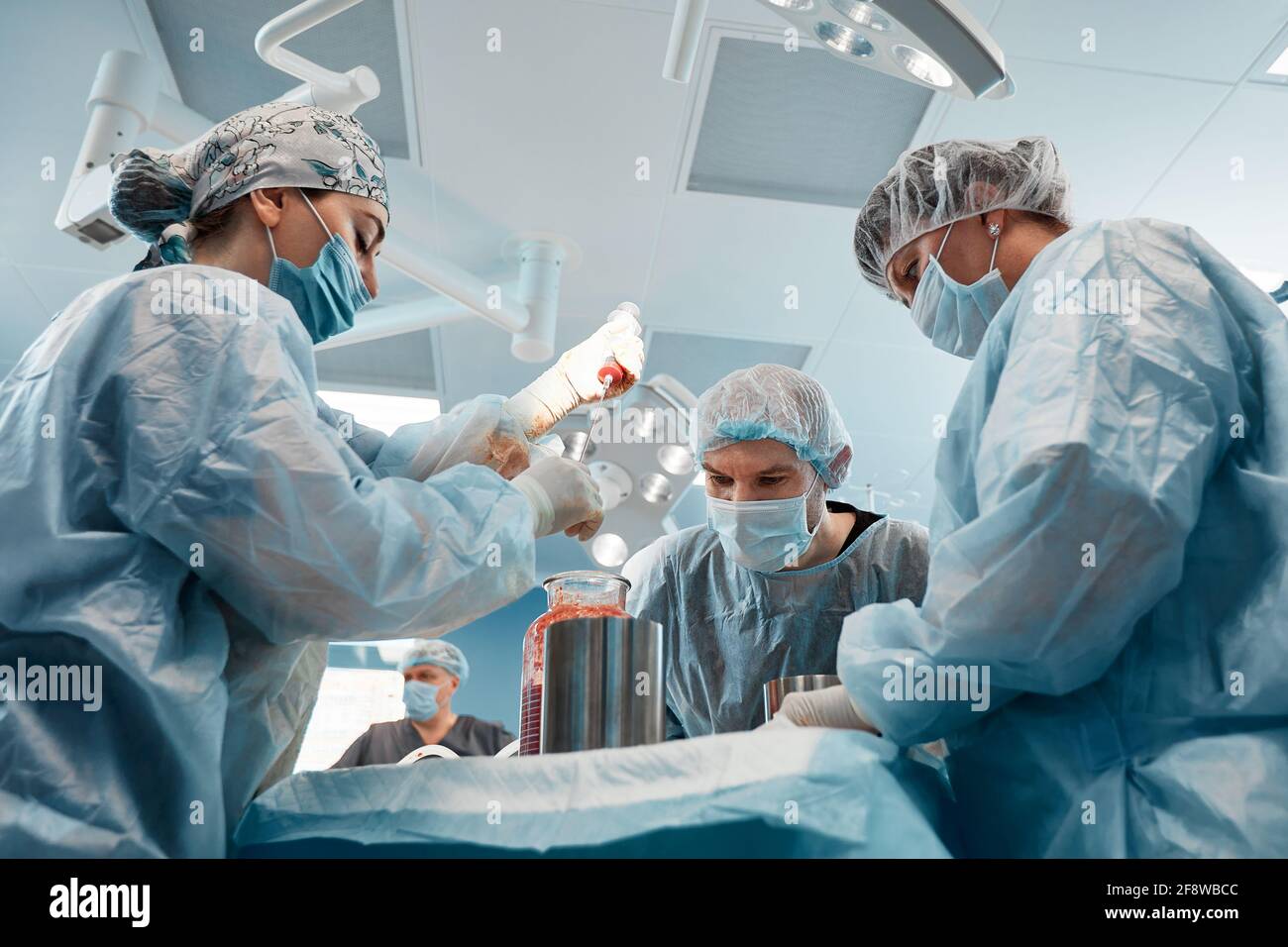 cosmetic liposuction surgery in actual operating room setting showing ...