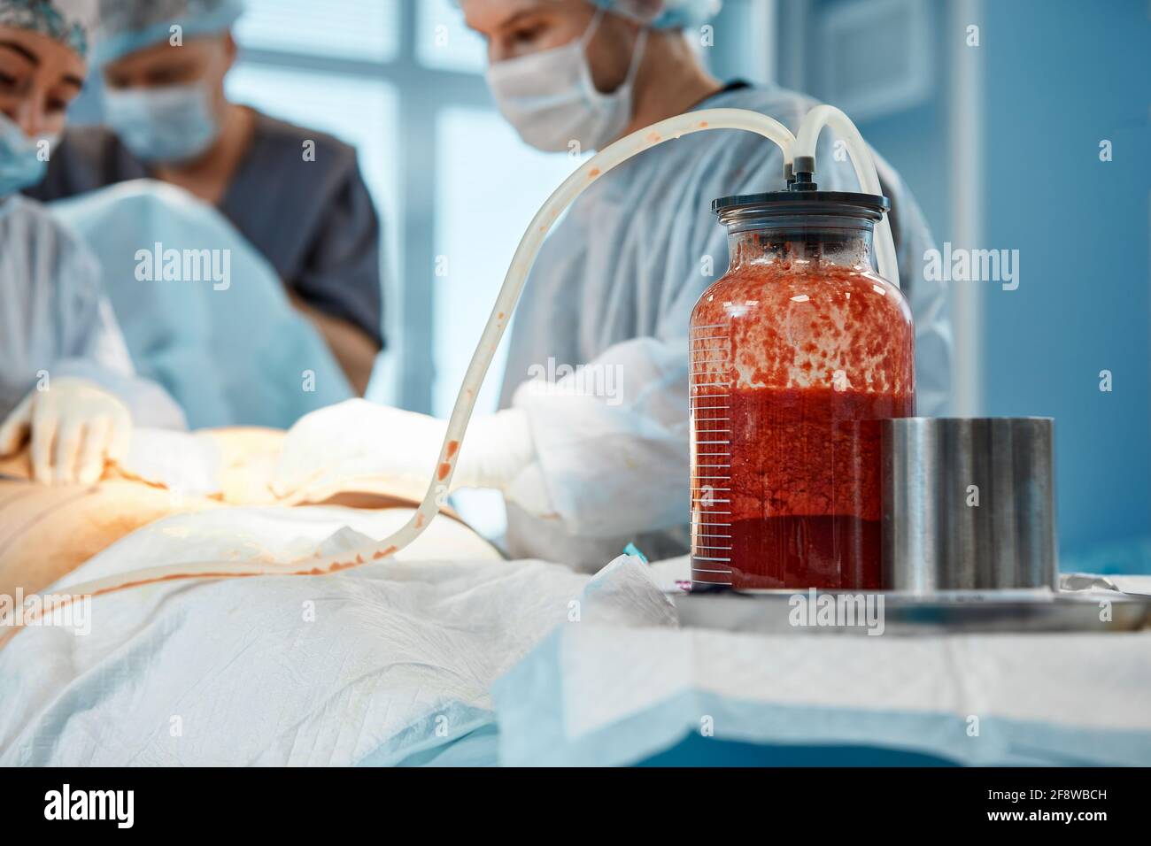 cosmetic liposuction surgery in actual operating room setting showing ...