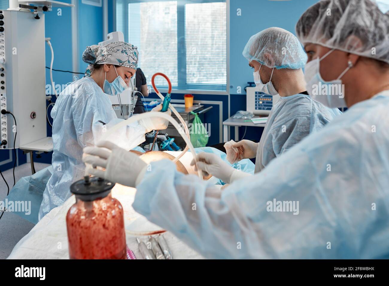 cosmetic liposuction surgery in actual operating room setting showing ...