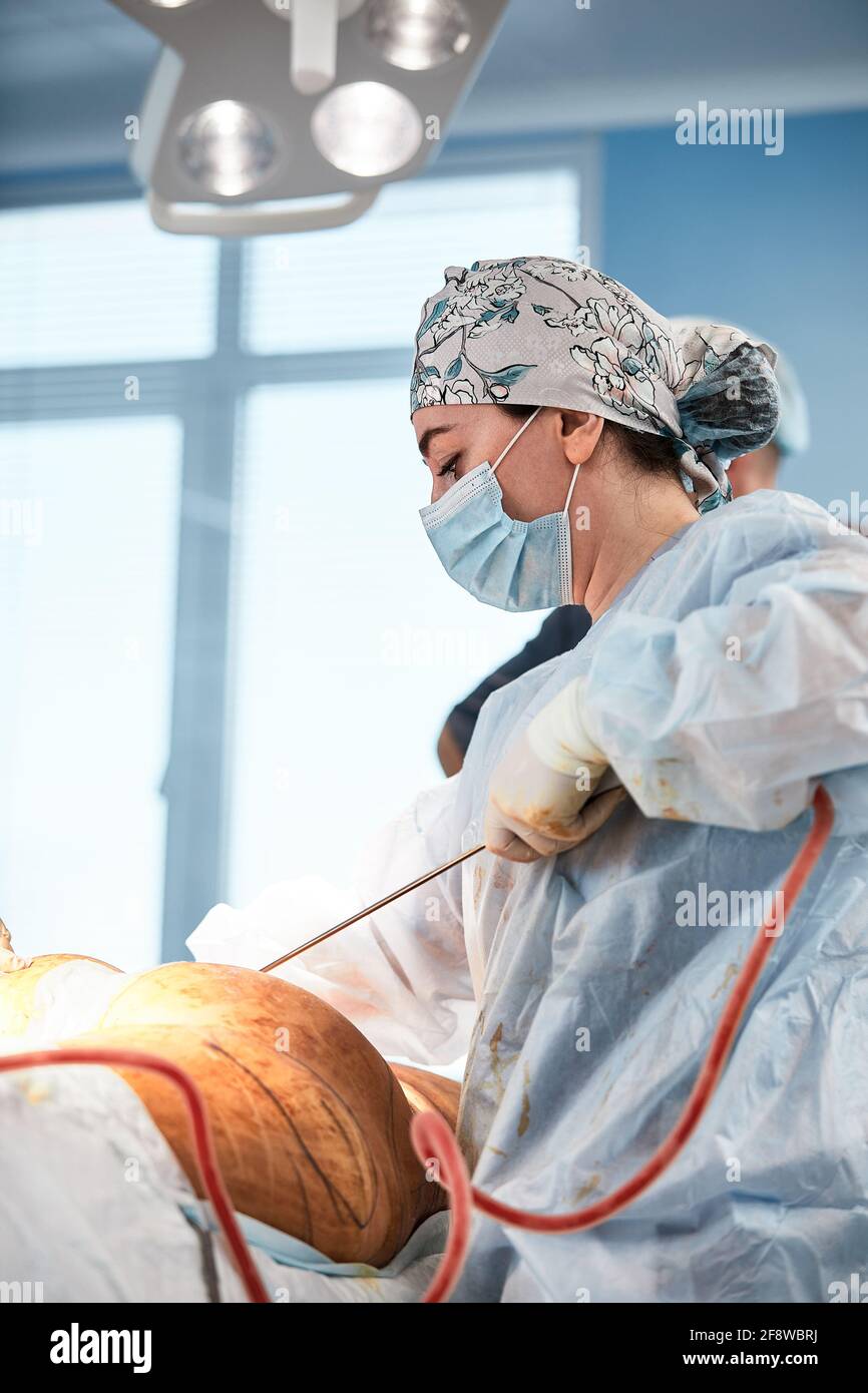 cosmetic liposuction surgery in actual operating room setting showing ...
