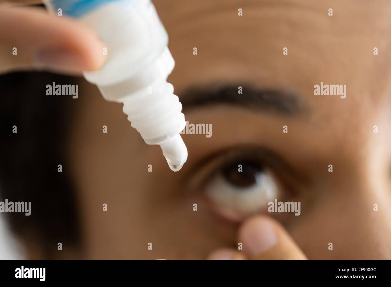 African Woman Pouring Eye Drop Medication For Glaucoma And ...