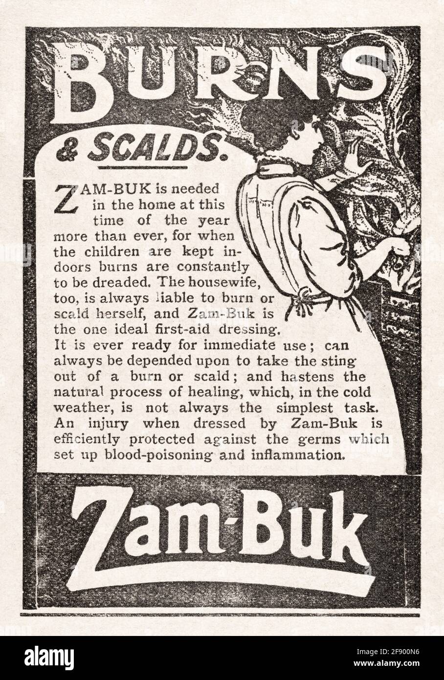 Old vintage Edwardian magazine Burn & Scald ointment advert from 1912 ...