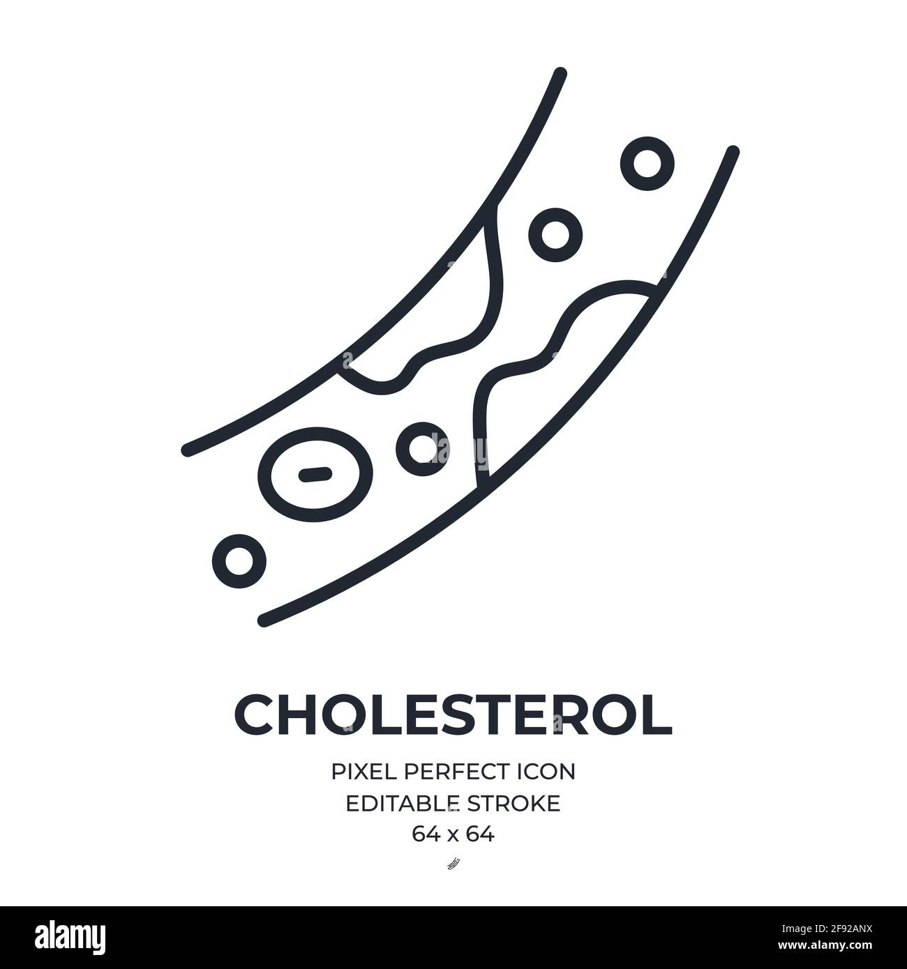 High cholesterol or atherosclerosis concept. Artery blocked by ...