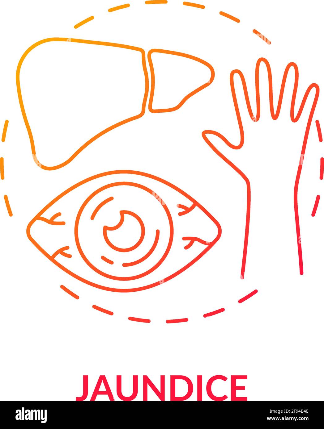 Jaundice Logo Causes For Jaundice Recurrence Shimla | Himachal Watcher