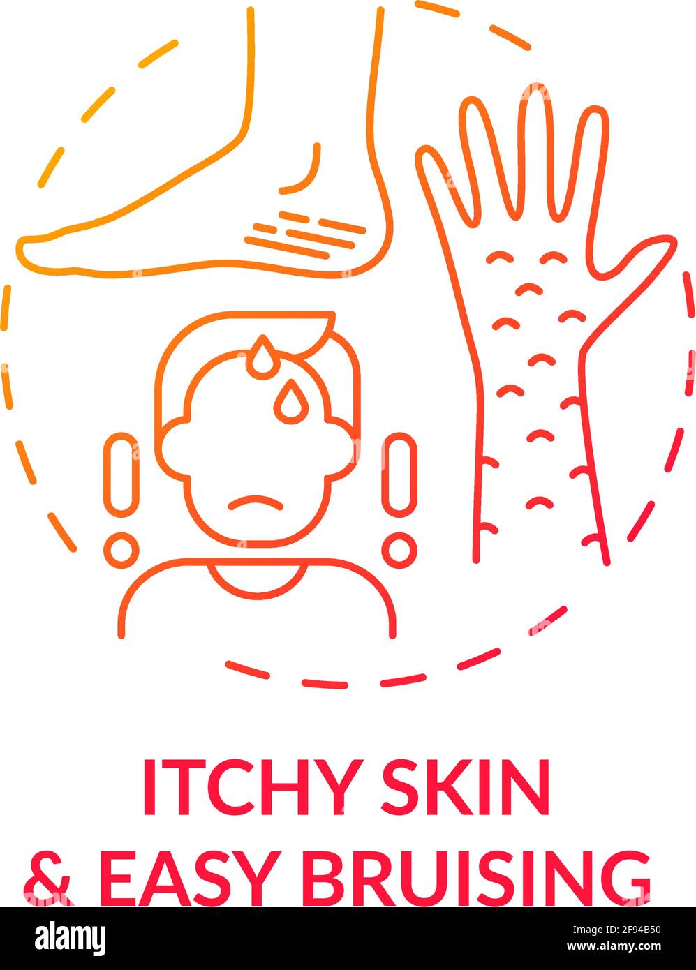 Itchy Rash With Bruising