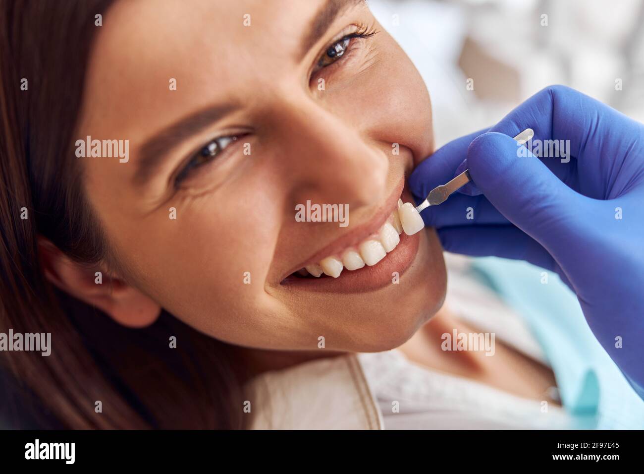 Male doctor put client artificial teeth to true ones. Whitening ...