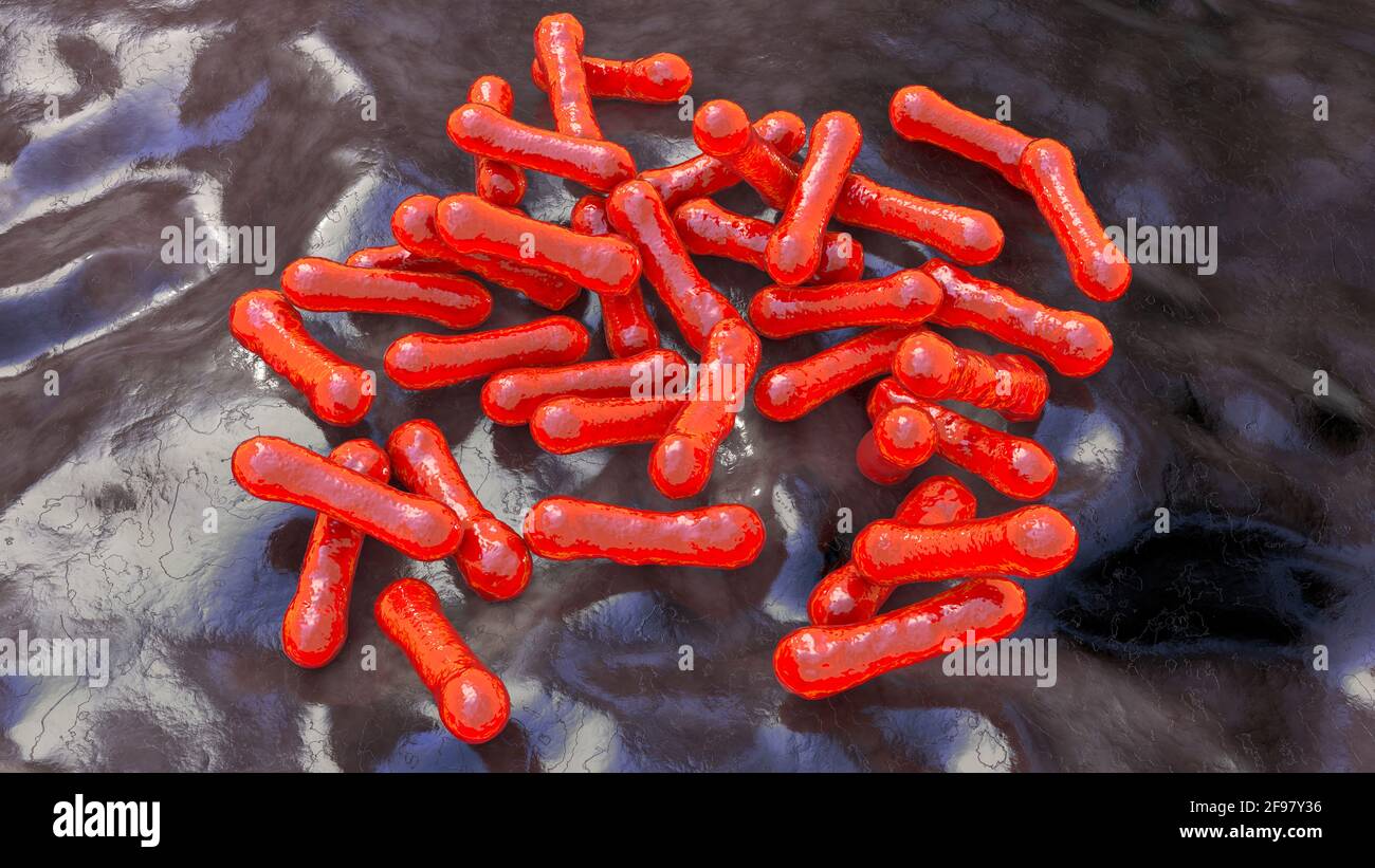 Corynebacterium Diphtheriae High Resolution Stock Photography and ...