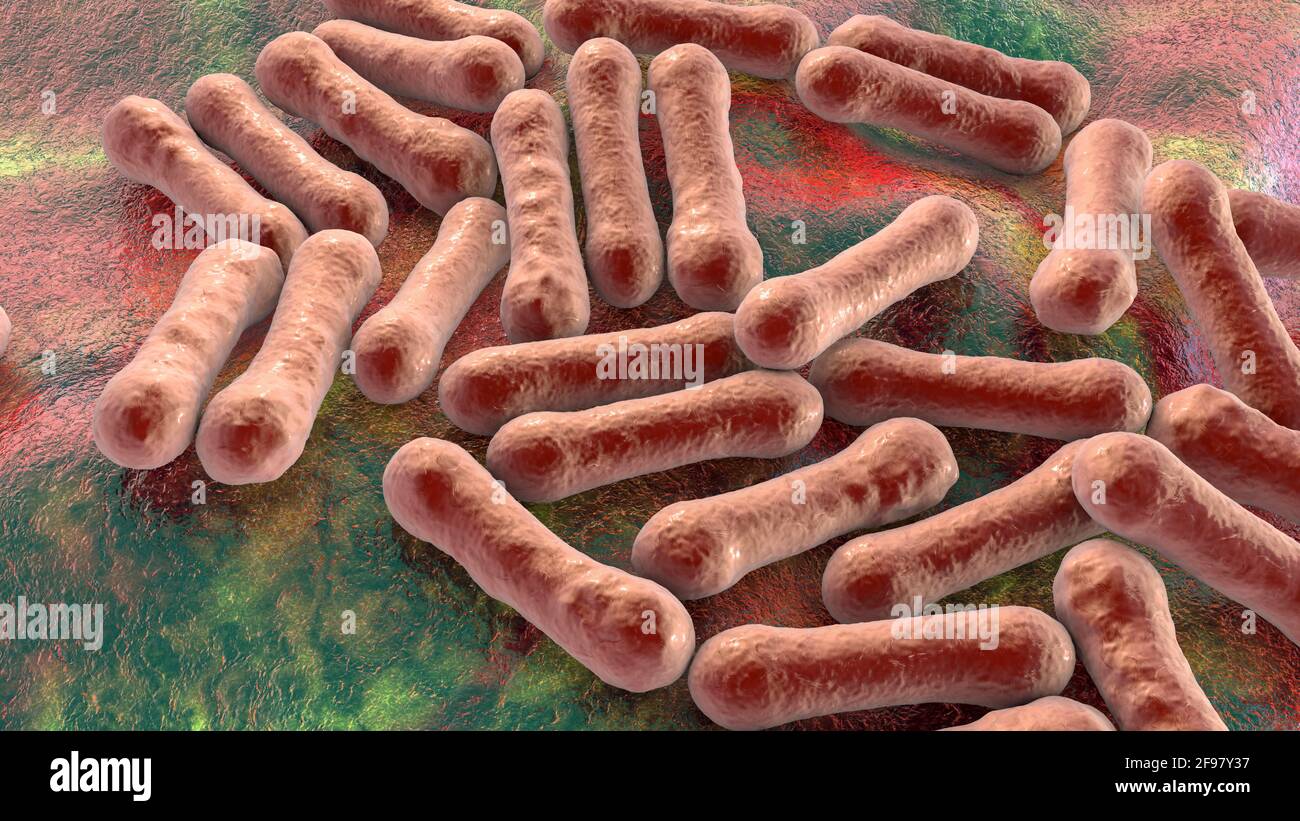 Corynebacterium diphtheriae, illustration Stock Photo - Alamy
