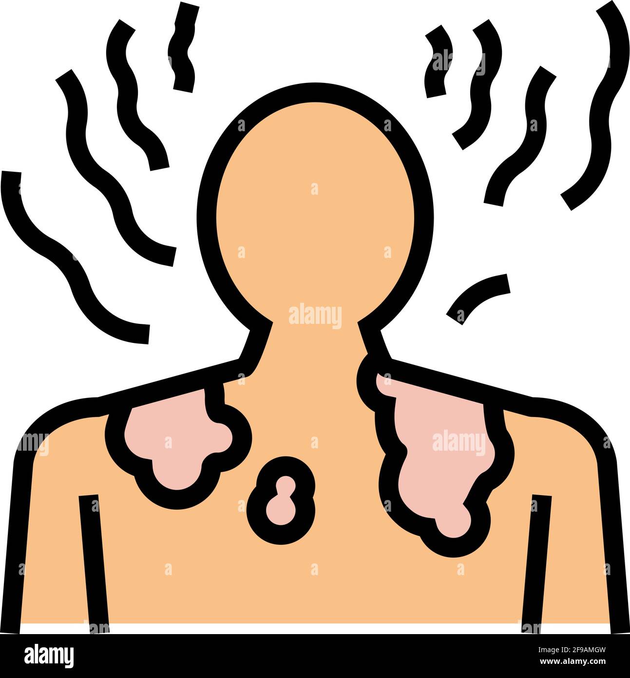 sunburn skin disease color icon vector illustration Stock Vector Image ...