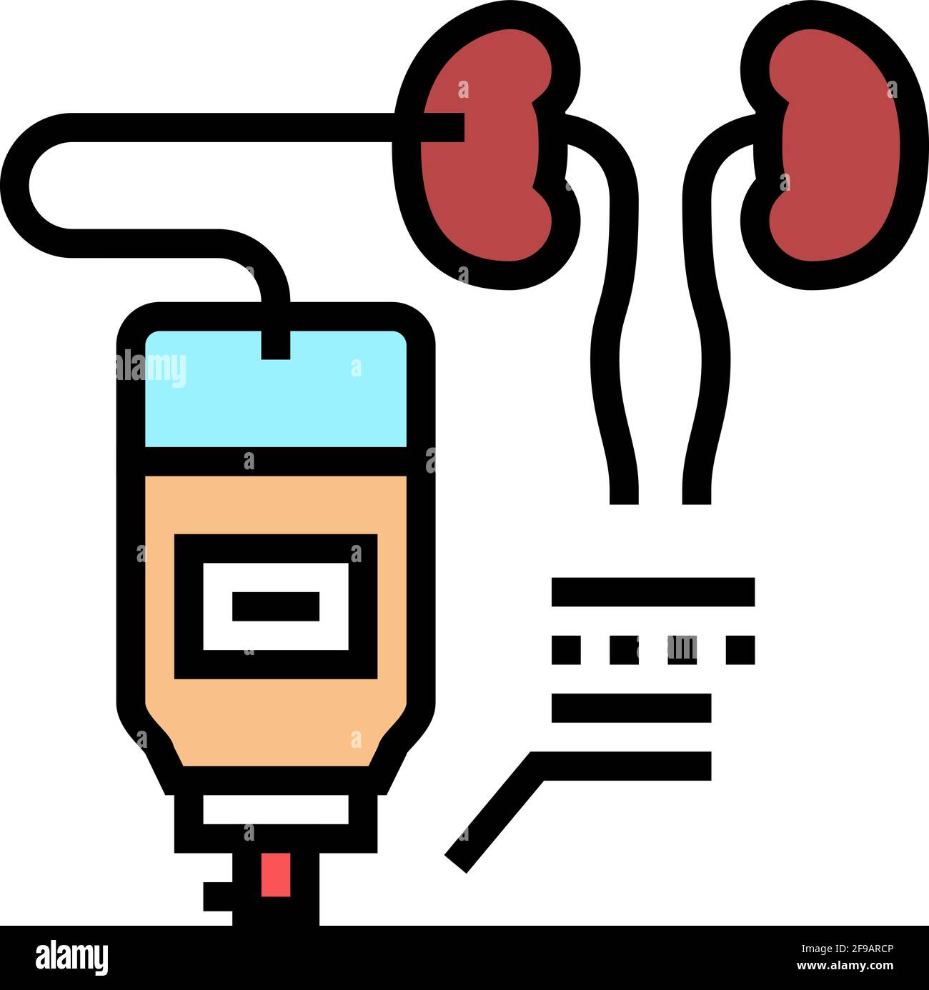 Nephrostomy hi-res stock photography and images - Alamy