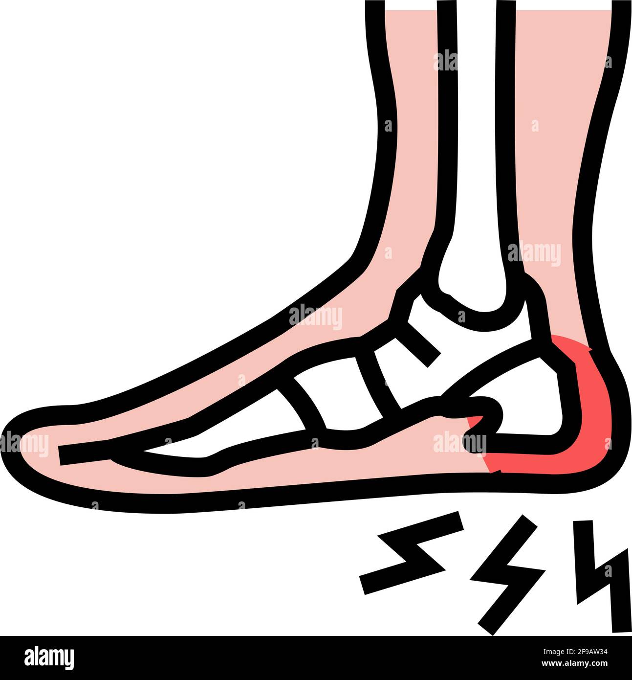 Heel Spur Disease Color Icon Vector Illustration Stock Vector Image And Art Alamy