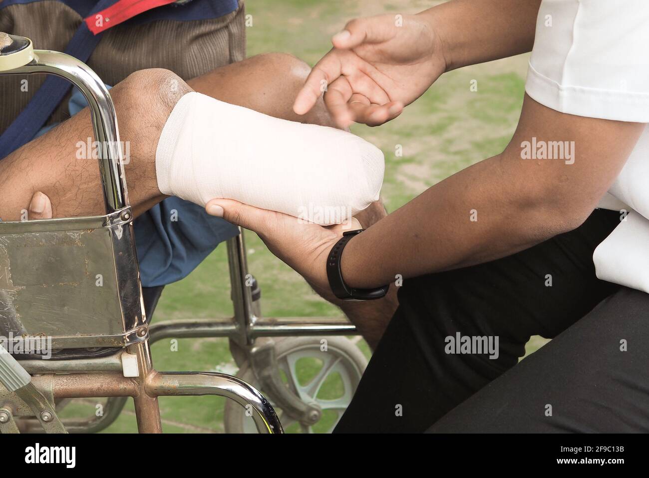 Leg Amputation Stump High Resolution Stock Photography and Images - Alamy