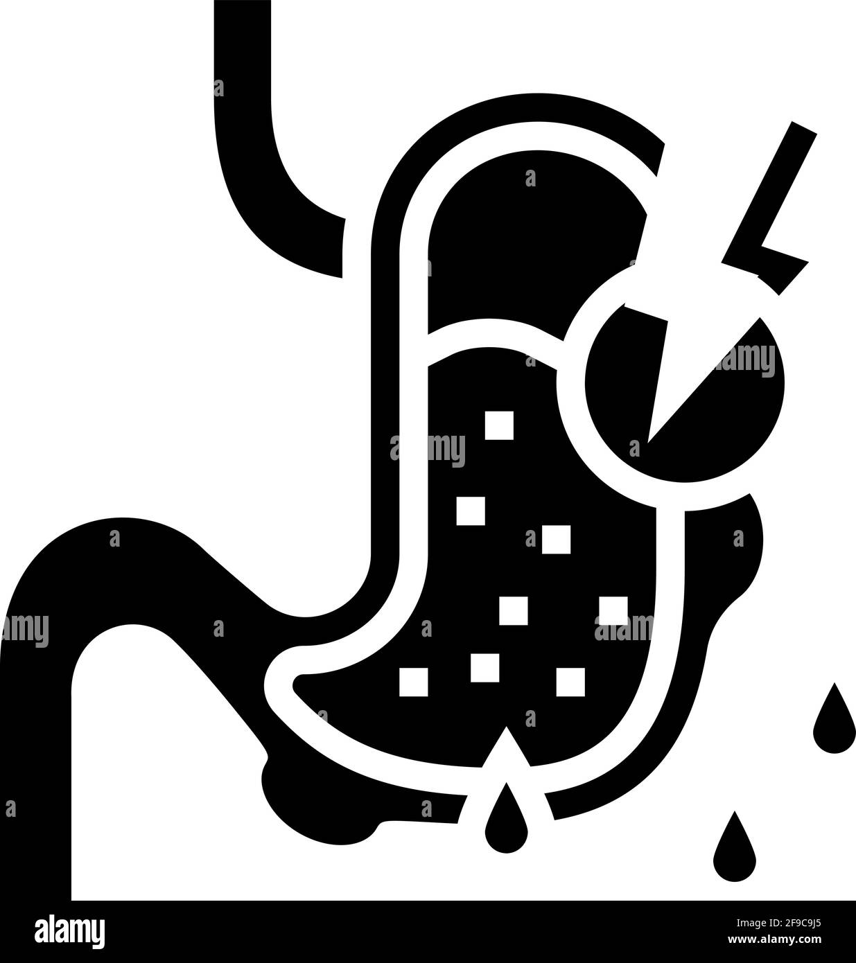 Gastrointestinal bleeding illustration hi-res stock photography and ...