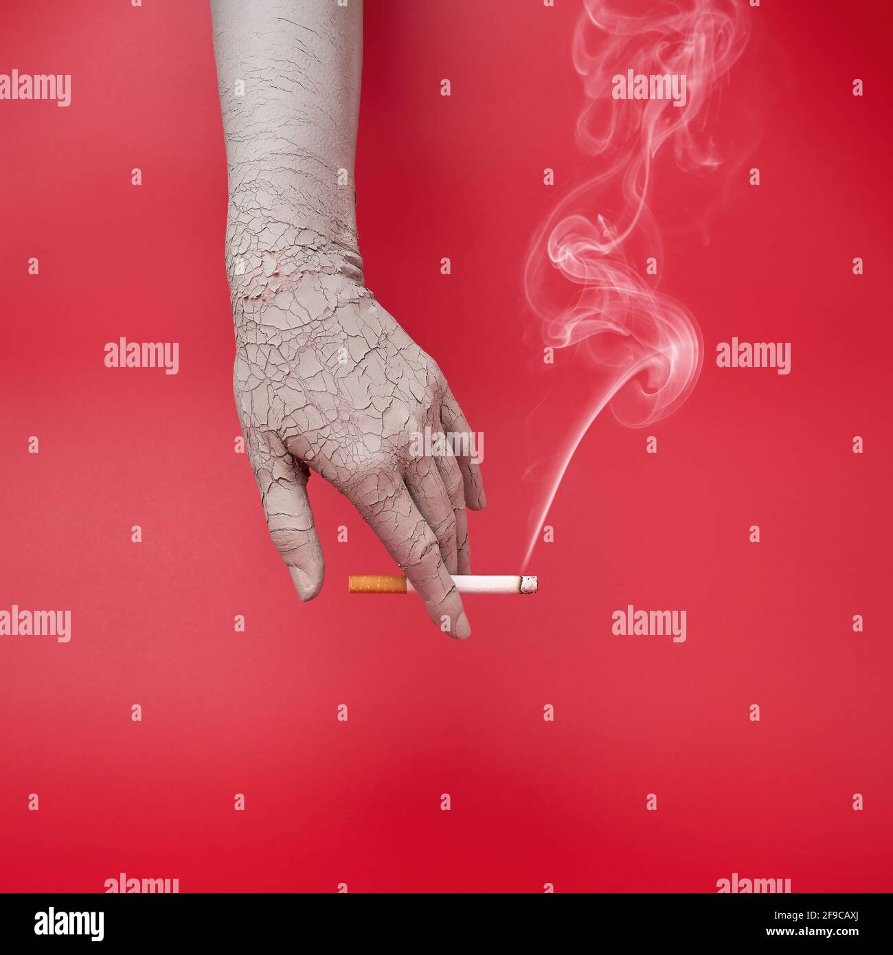 Cracked skin hi-res stock photography and images - Alamy