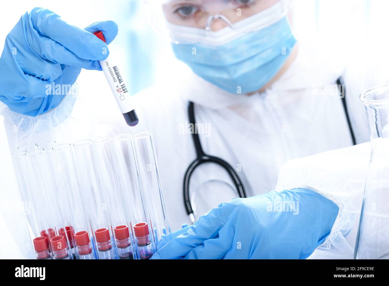 Lab testing tube positive hi-res stock photography and images - Alamy