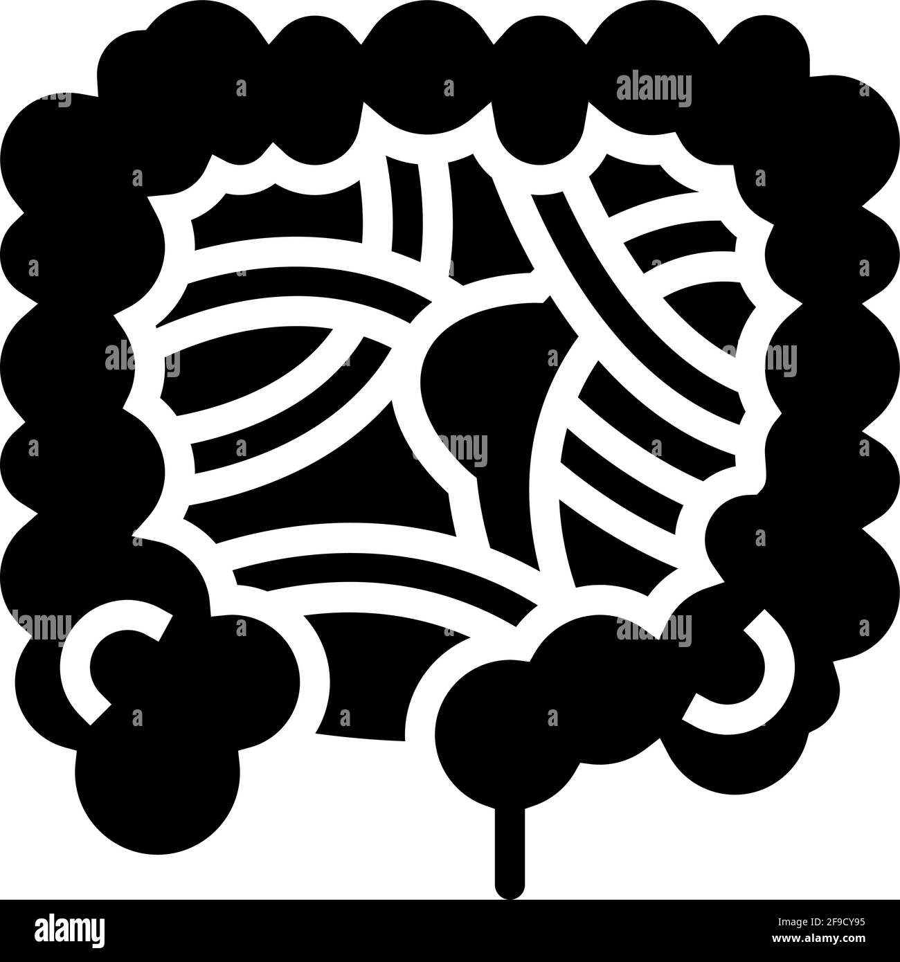 Intestinal obstruction Black and White Stock Photos & Images - Alamy