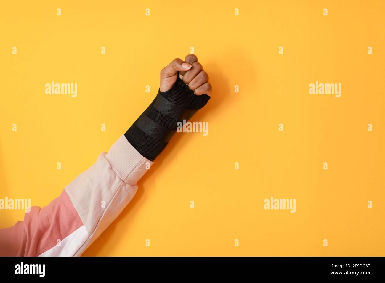 hand injury. a female injured hand on a yellow background Stock Photo ...