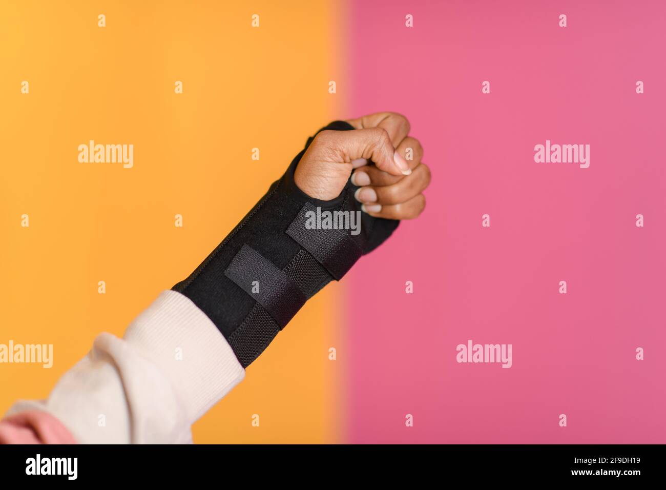 hand injury. a female injured hand on a yellow background Stock Photo ...