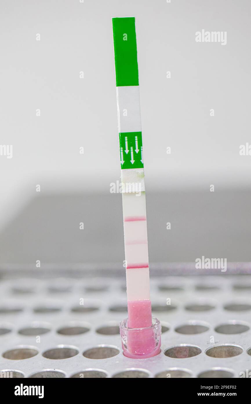 Antibiogram hi-res stock photography and images - Alamy