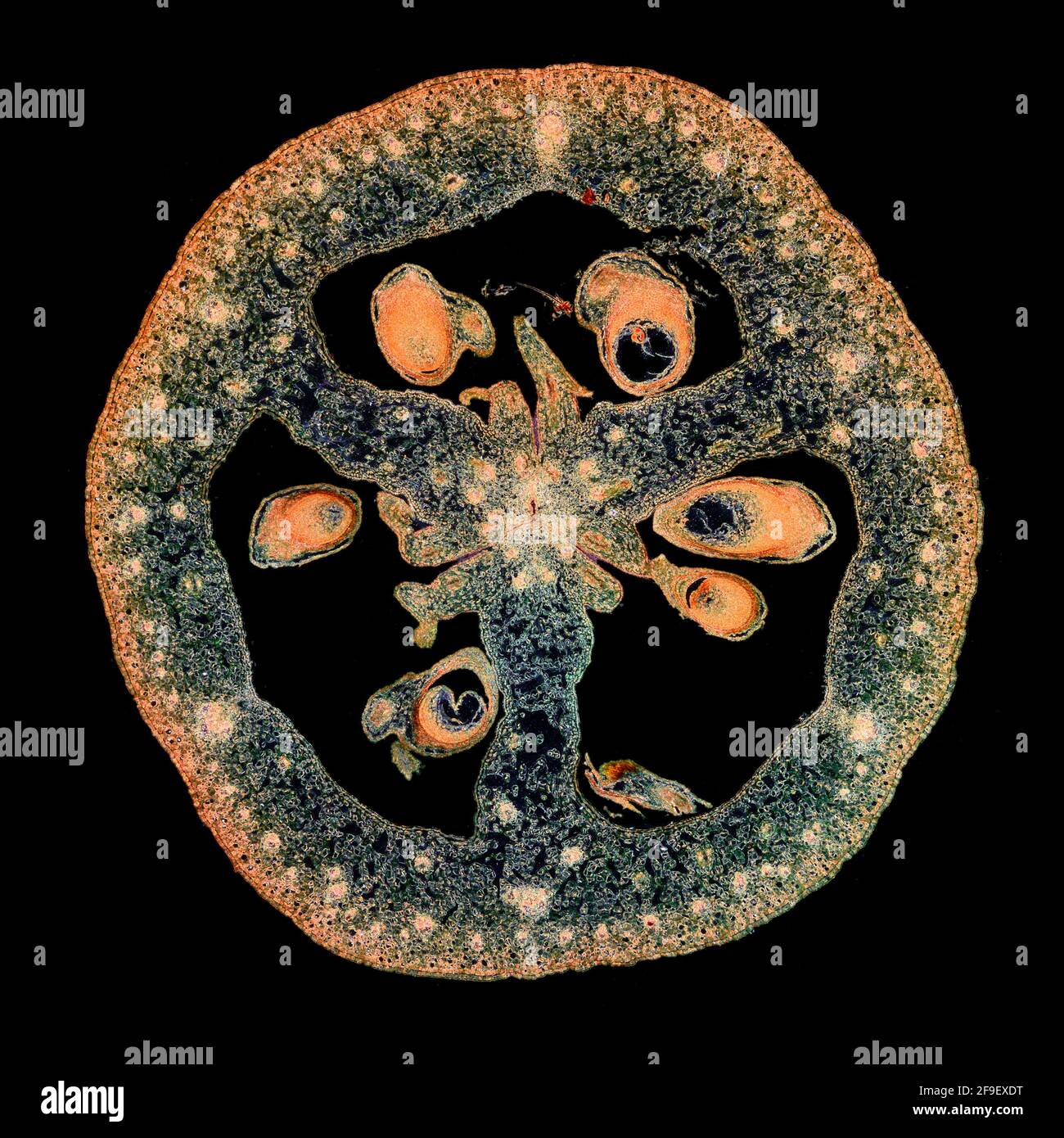 Photomicrograph ovary hi-res stock photography and images - Alamy