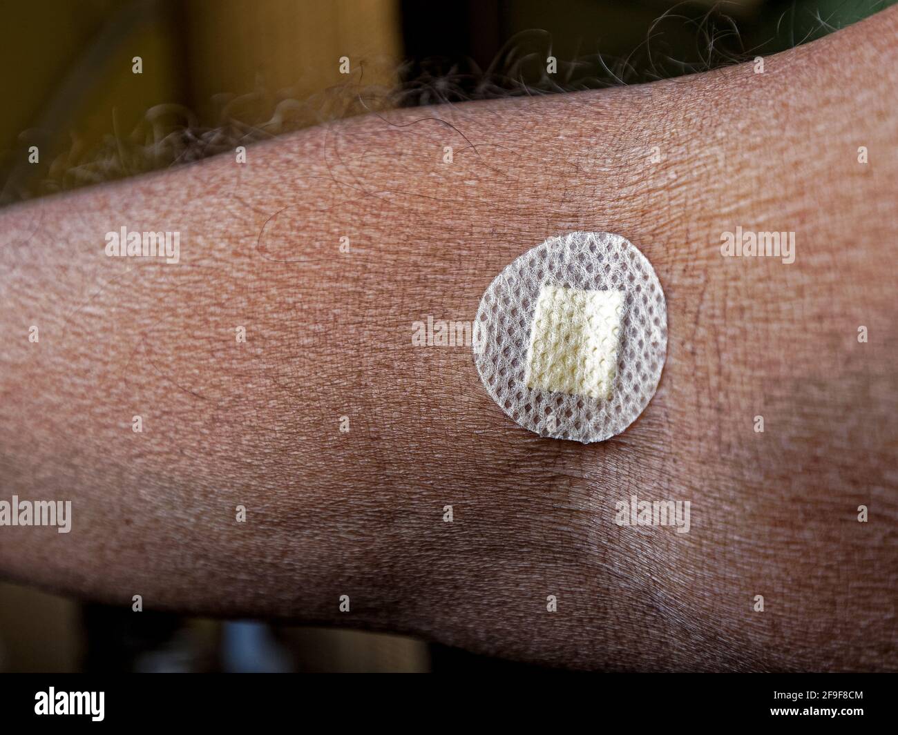 Puncture Wound High Resolution Stock Photography and Images - Alamy