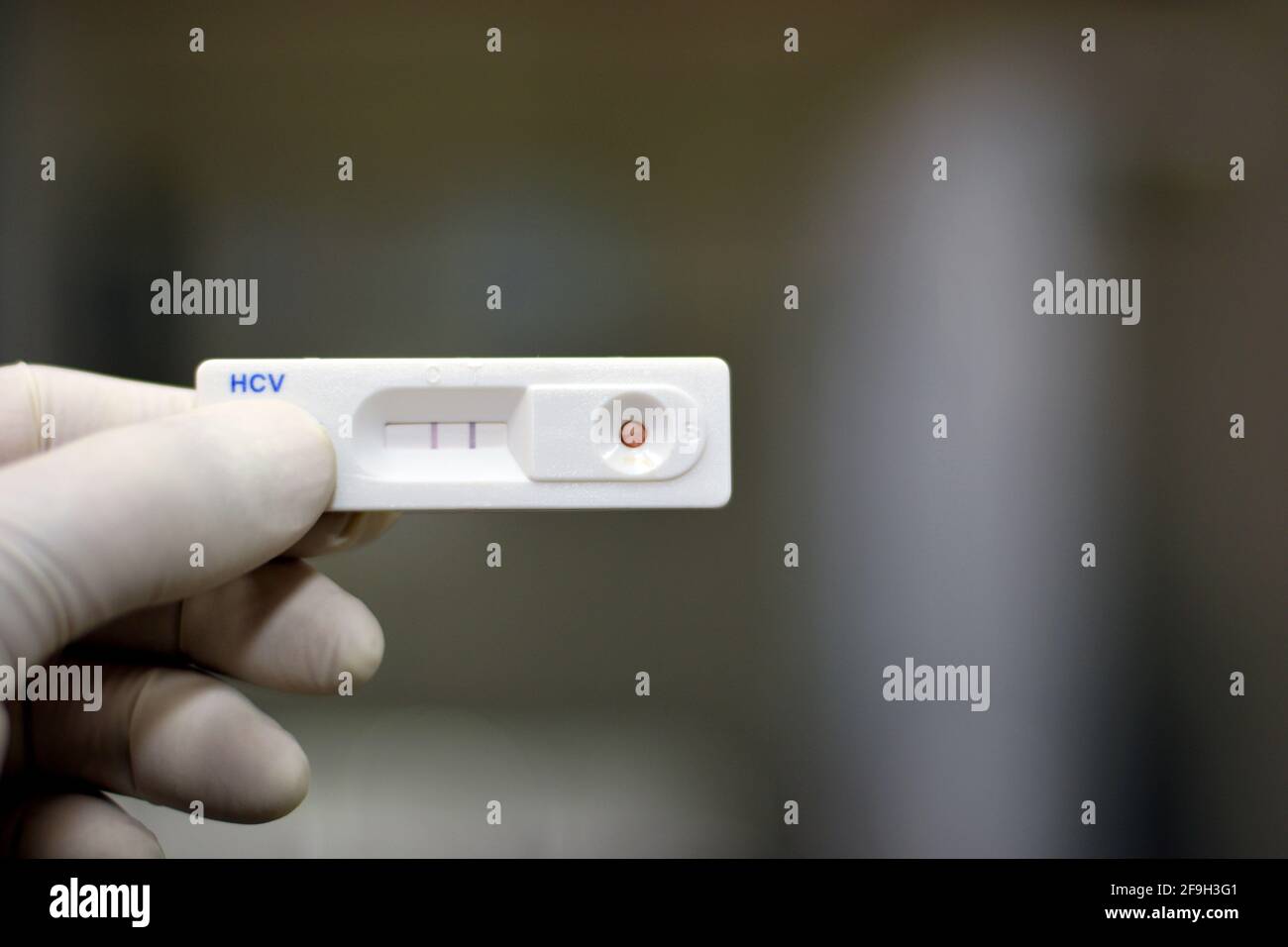 A positive result for Hepatitis C rapid test kit cassette that checks ...