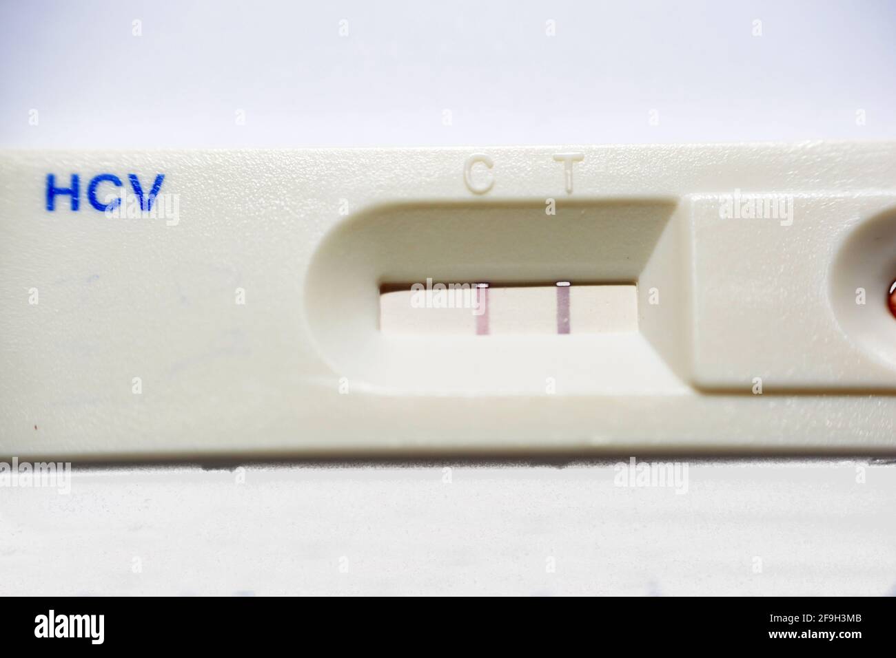 A positive result for Hepatitis C rapid test kit cassette that checks ...