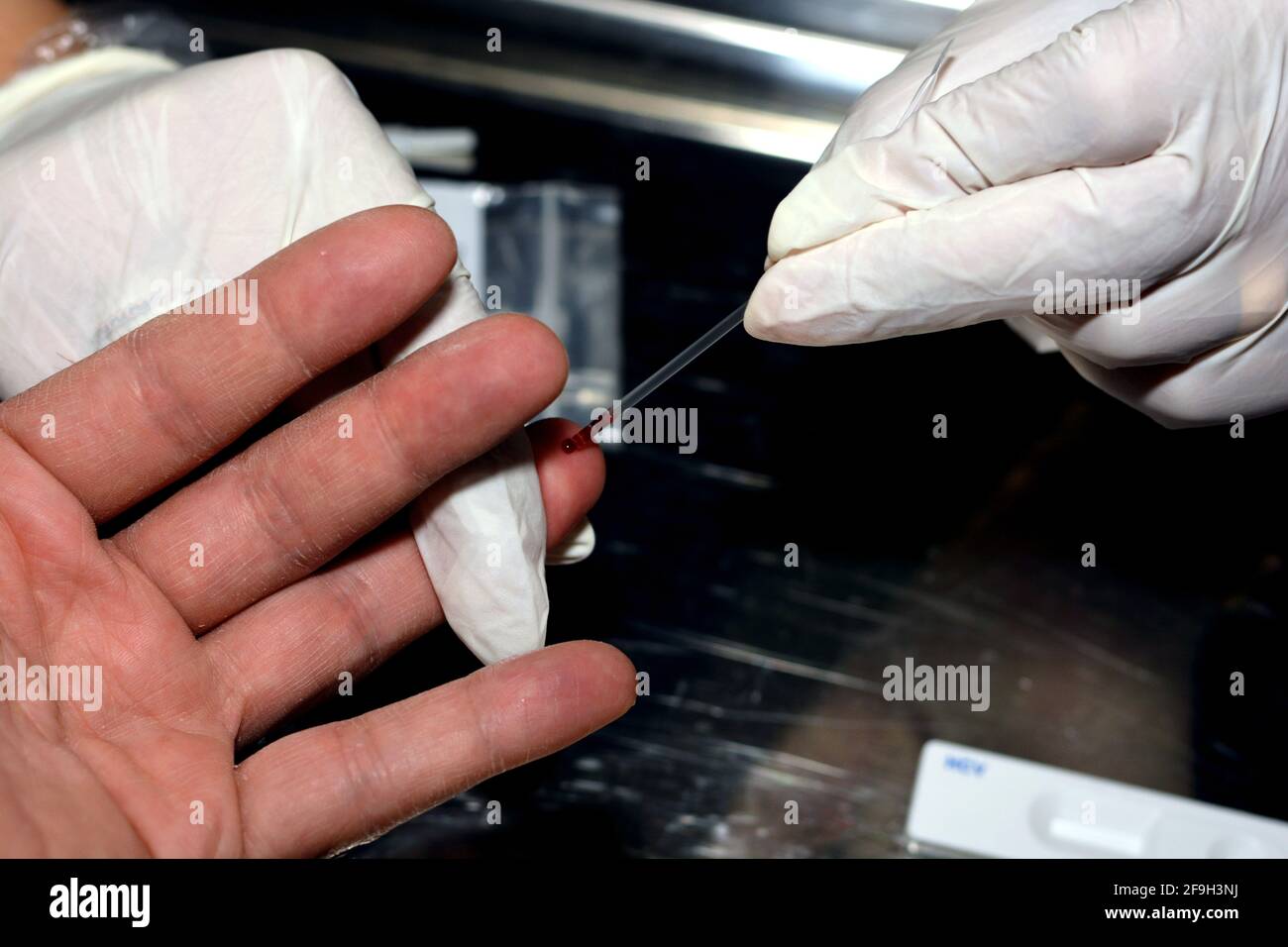 a medical personnel making a rapid test of virus c for a patient ...
