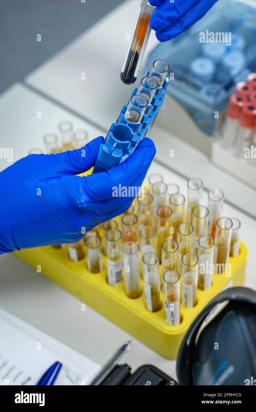 medical test tube in hand in blue gloves Stock Photo - Alamy
