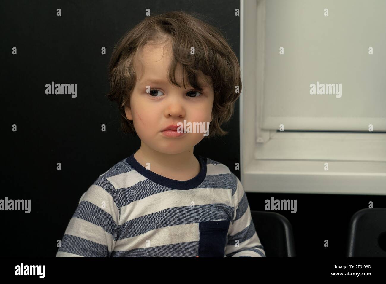 Scratch On Cheek High Resolution Stock Photography and Images - Alamy