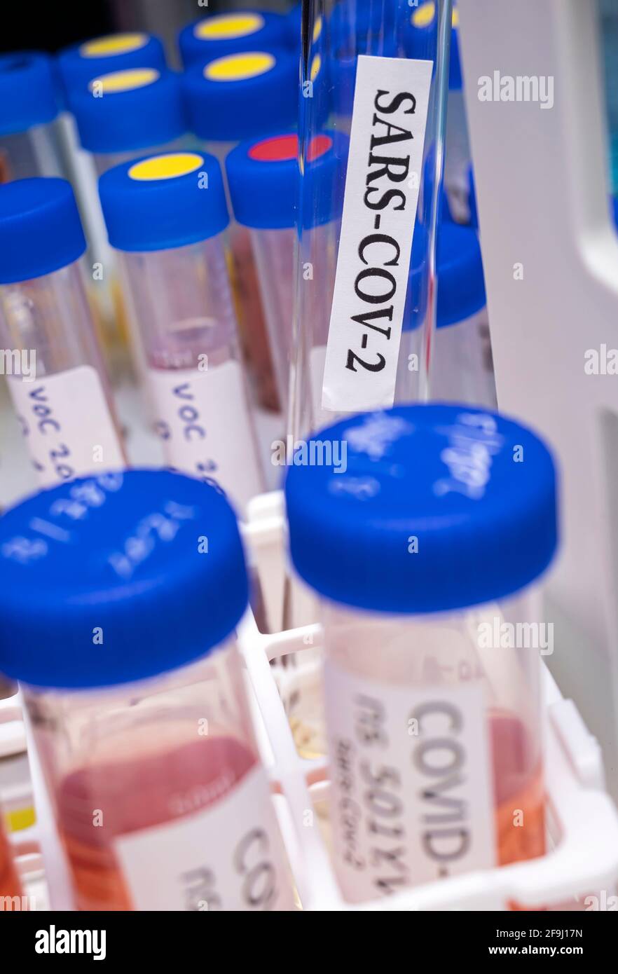 Sars v2 hi-res stock photography and images - Alamy