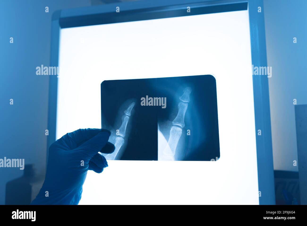 Medical workers in hospital examine x-ray prints Stock Photo - Alamy