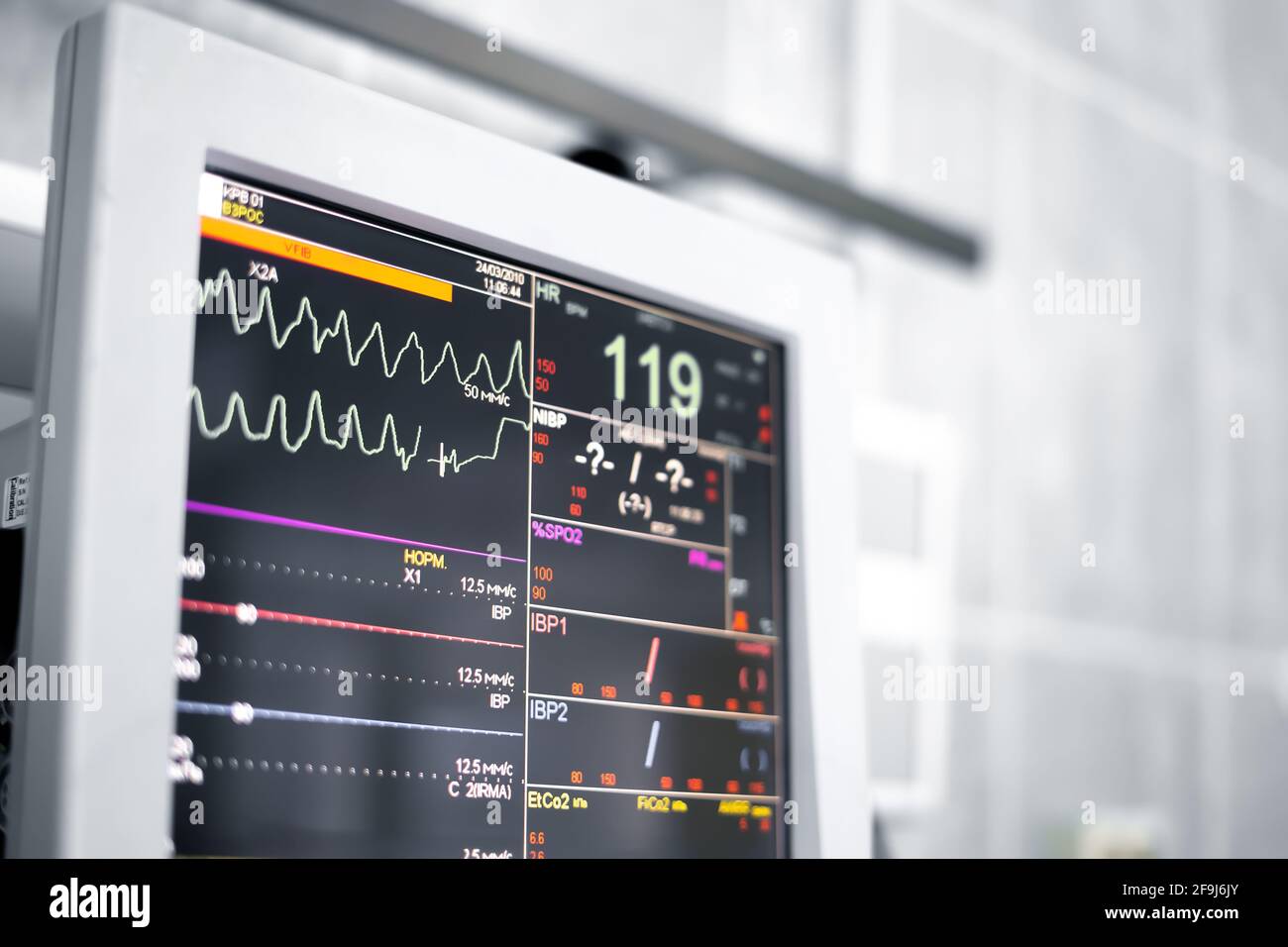 Medical monitor machine in operation room show normal vital sign of the ...