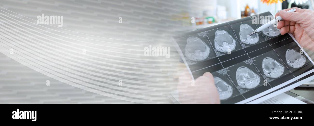 Doctor analyzing a mri scan, closeup; panoramic banner Stock Photo - Alamy