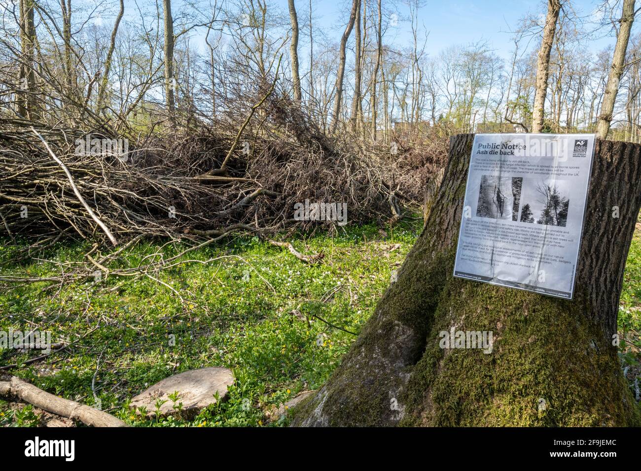 Ash dieback tree disease notice in woodland with ash trees chopped down ...